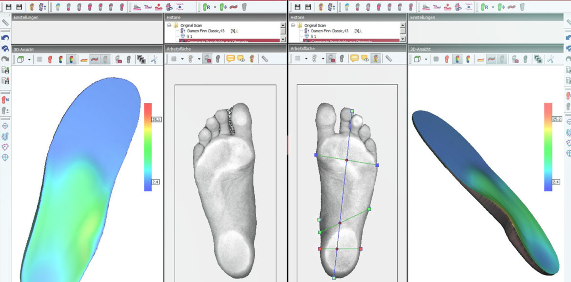Paromed Blog - Milled orthopedic insoles - Your advantages with paromed